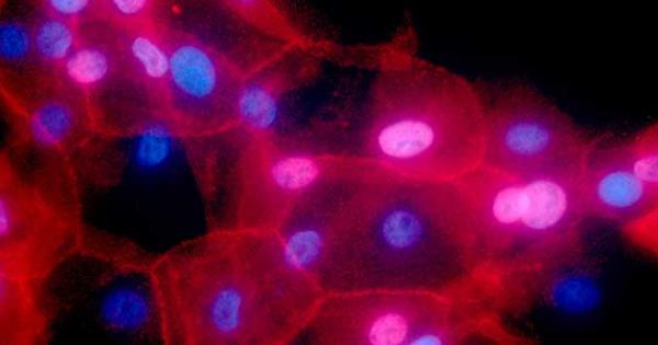 Desarrollan en Rusia microcápsulas para diagnóstico de cáncer