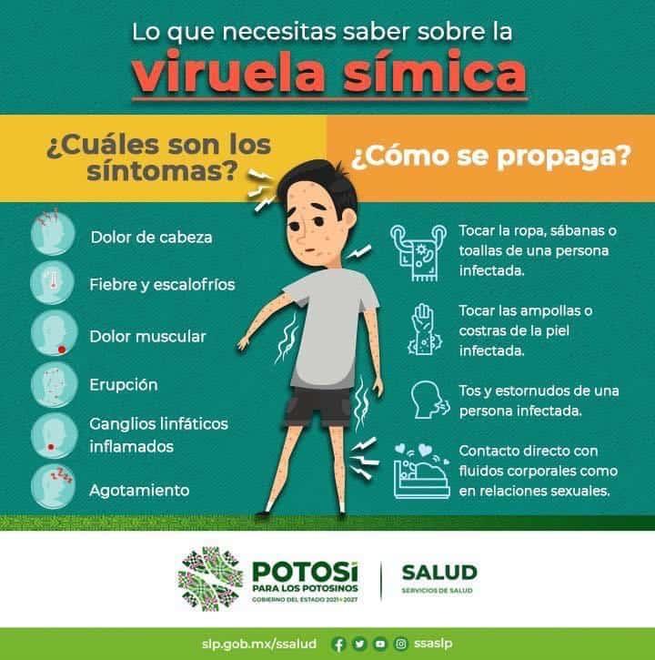 Detectan El Tercer Caso De Viruela Símica En Slp