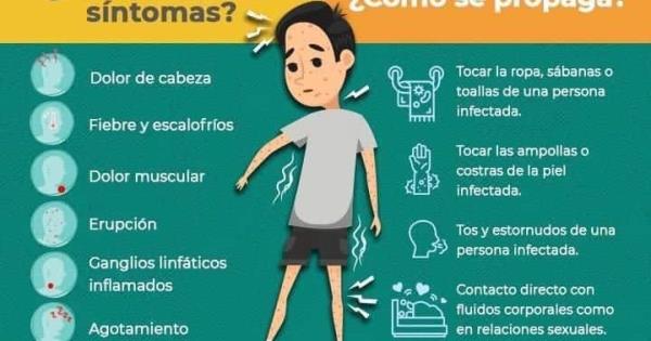 Detectan Dos Nuevos Casos De Viruela Símica En Slp Ya Suman Cinco